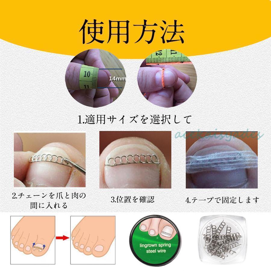 国内巻き爪 矯正 巻き爪チェーン 治療 爪ワイヤー テープ付き 12個 自宅で治す 矯正器具 爪切り ネイルエイド セルフケア サポーター : 旅とびshokin - 通販 - Yahoo ...