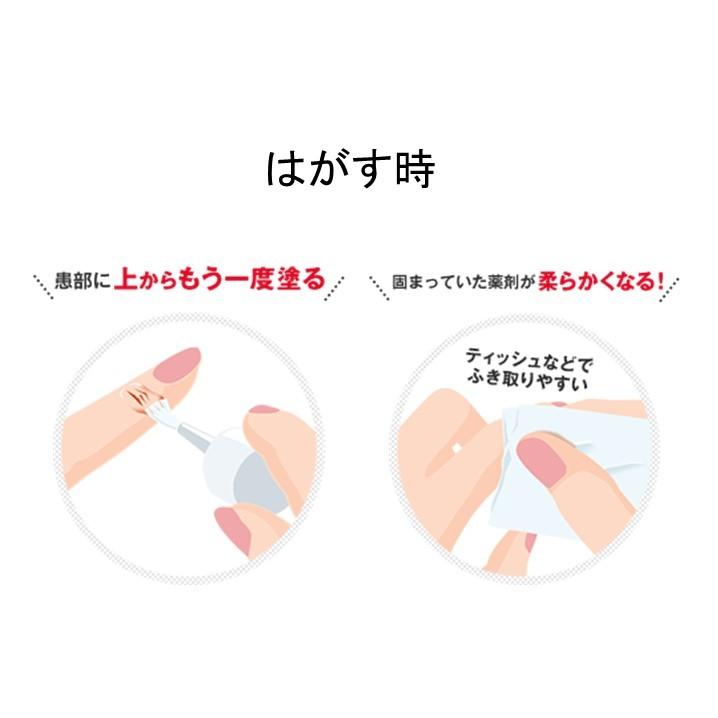 【第3類医薬品】サカムケア 10g :4987072011225:大慶堂さんあい薬局Yahoo!店 - 通販 - Yahoo!ショッピング