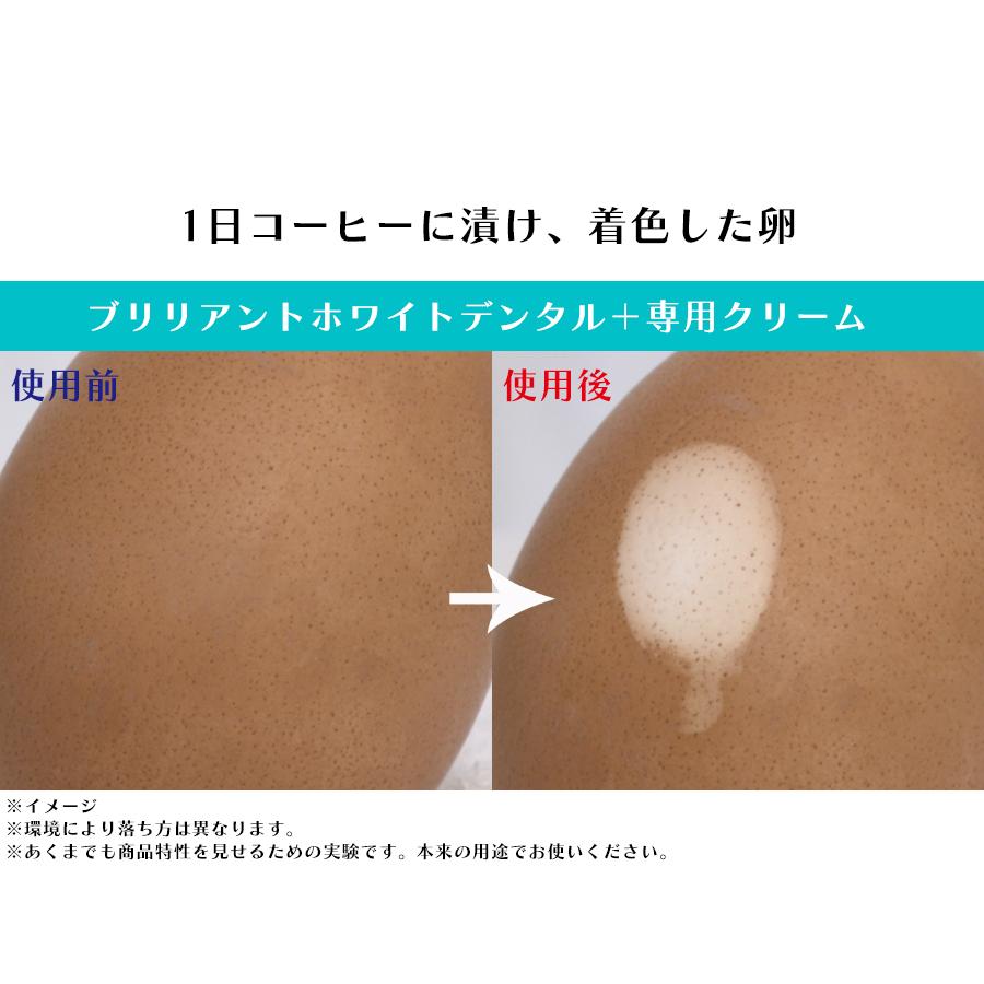 ブリリアント ホワイト デンタル セット / Brilliant 歯 白 磨く 着色 汚れ 電動 【TBSショッピング】 :m0001270:TBSショッピング - 通販 - Yahoo!ショッピング