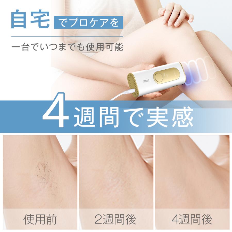 TAKUYO 脱毛器 家庭用脱毛器 HIPL光美容器 光脱毛器 脱毛 全身 TAKUYO 脱毛器 家庭用脱毛器 HIPL光美容器 光脱毛器 脱毛 全身