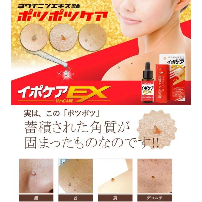イポケアEX 18ml 首 イボ 美容液 ブレーンコスモス イポケア 角質ケア 正規品 イボ取り いぼ 除去 : 0480-016291 : ベリーストア - 通販 - Yahoo!ショッピング