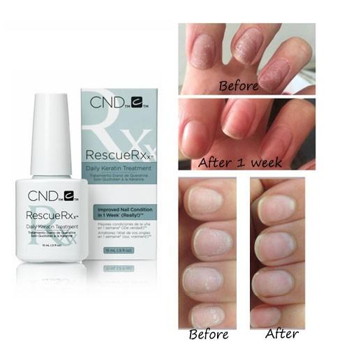 CND 送料無料 RX（アールエックス） デイリー ケラチン ネイルトリートメント 15ml : Vienail Yahoo!店 - 通販 ...