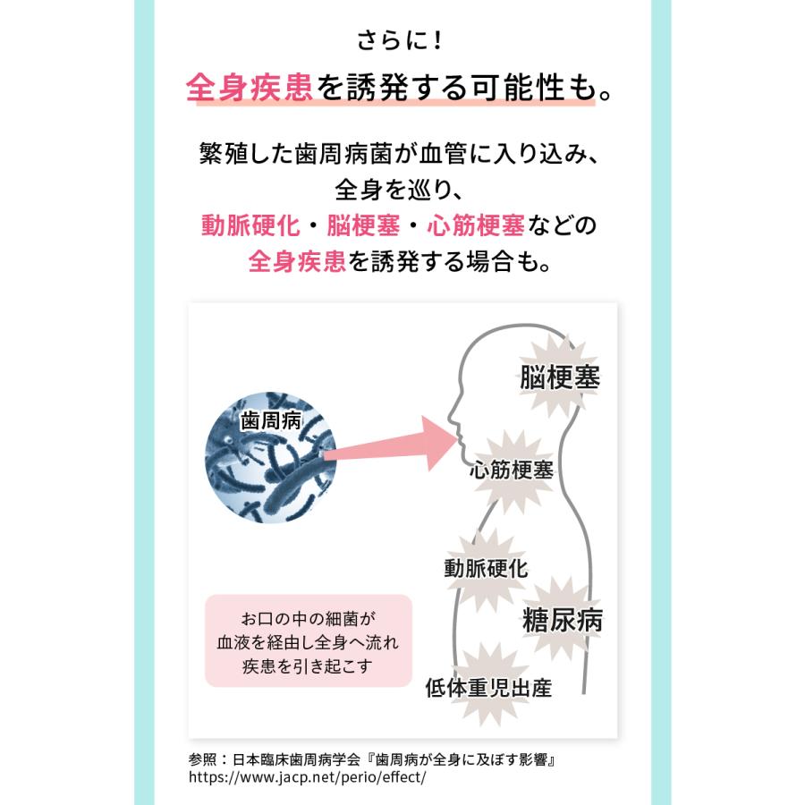 【1/5〜 MAX20%OFF】歯周病 予防 歯磨き粉 ホワイトエッセンス ペリオテクト 医薬部外品 シトラスミックス味 歯 高級 歯科 研磨剤なし フッ素 CPC IPMP ...