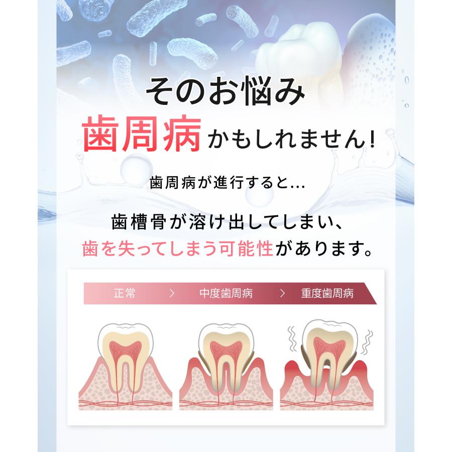 歯周病 予防 歯磨き粉 ホワイトエッセンス ペリオテクト 医薬部外品 シトラスミックス味 歯 高級 歯科 研磨剤なし フッ素 CPC IPMP : periotect : ホワイトエッセンス ...