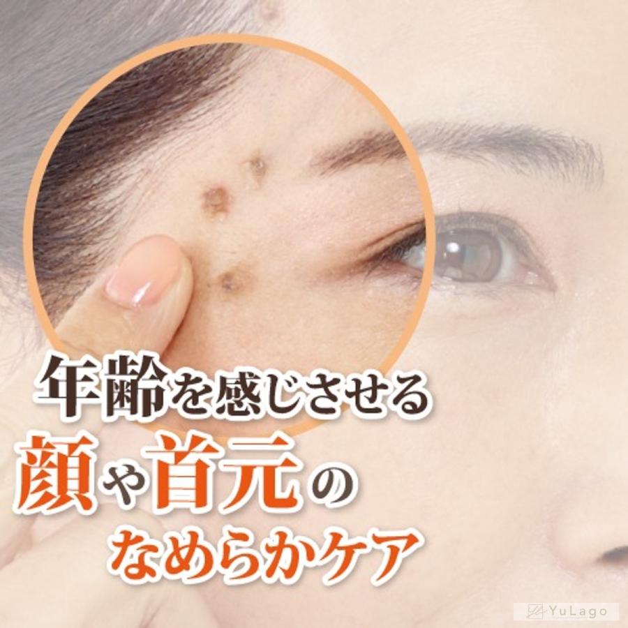 イポロンL イボ取り 顔 手足 肌 ぽつぽつ 美容オイル スキンケア 肌荒れ 角質つぶ くすみ ごわつき カサカサ 乾燥 美容ケア 15ml 1本 : YuLago(ユラゴ) - 通販 ...