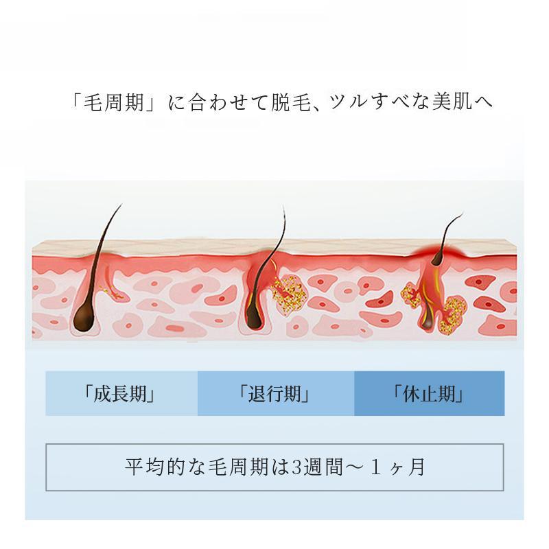 【クーポンで5,380円】脱毛器 vio対応 21Jパワー 全身快速脱毛 サロン級HIPL＆サファイア氷感 冷感 5段階レベル 5種類照射モード : 夢の森 - 通販 - Yahoo!ショッピング