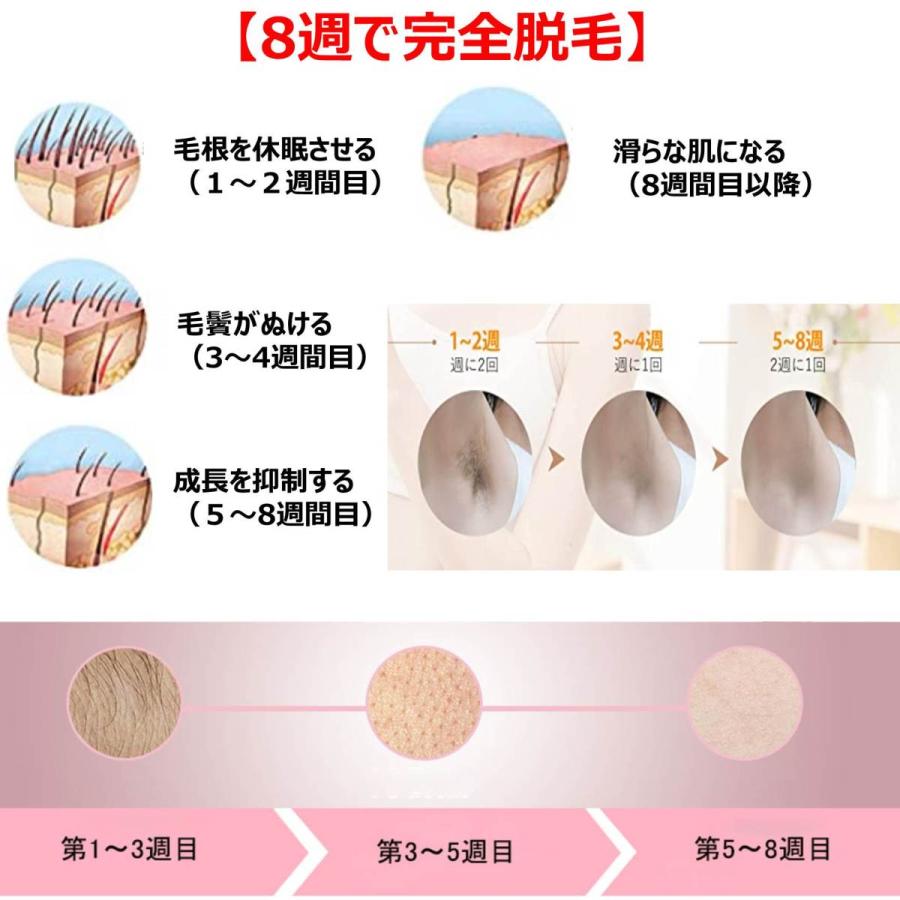IPL光脱毛器 レーザー 脱毛器 光美容器 家庭用脱毛器 VIO ワキ 腕 足 背中 ビキニライン 全身脱毛 男女兼用 国内PSE認証済み 1年保証 : 夢の洲ヤフー店 - 通販 ...