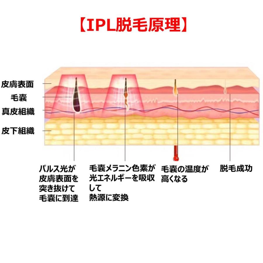 IPL光脱毛器 レーザー 脱毛器 光美容器 家庭用脱毛器 VIO ワキ 腕 足 背中 ビキニライン 全身脱毛 男女兼用 国内PSE認証済み 1年保証 : 夢の洲ヤフー店 - 通販 ...